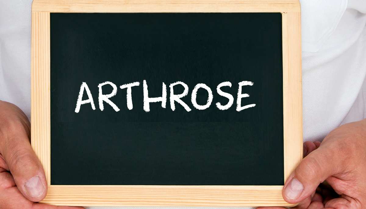 Arthrose: Überblick | Arthrose